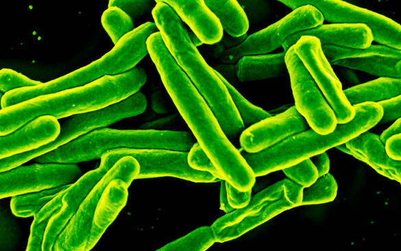 Un agent patogen vechi de mii de ani încă circulă în corpul nostru ...