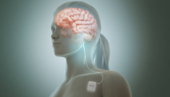 Nervul vag, cel mai lung nerv al sistemului nervos vegetativ - Info Natura