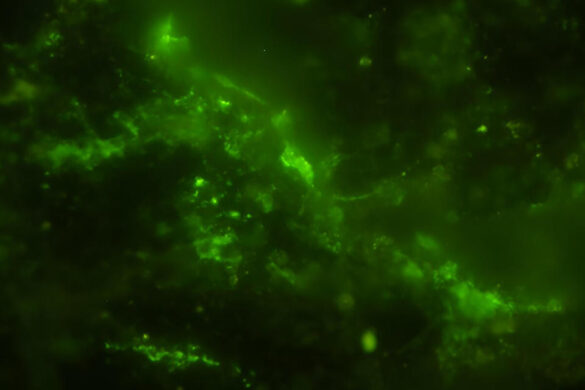 Membrana celulară (partea a IV-a): endocitoza și exocitoza - Info Natura