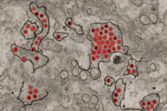 Virusurile: structură, clasificare, reproducere - Info Natura